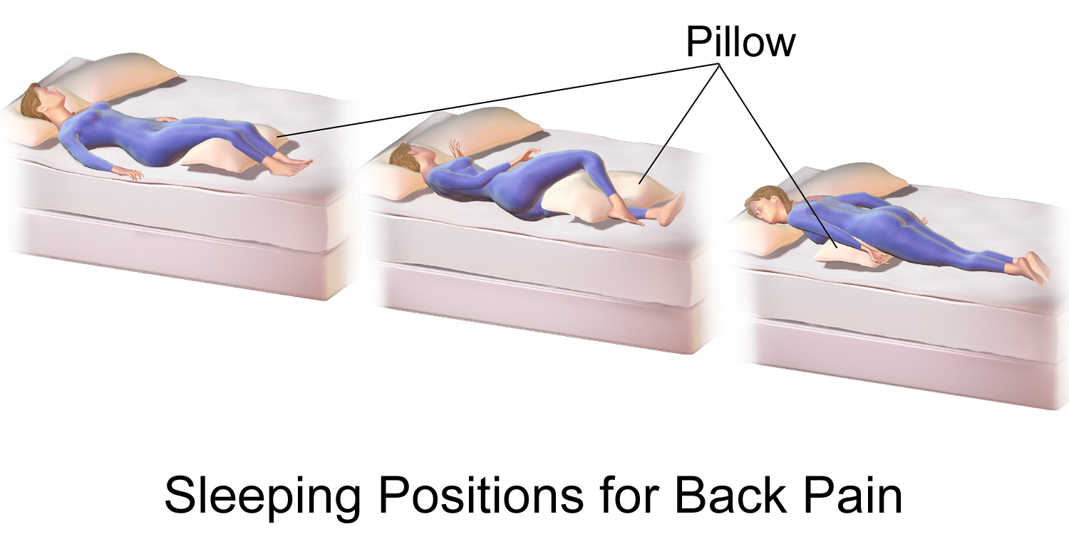 HNPP and Sleep Positions – HNPP Wellbeing